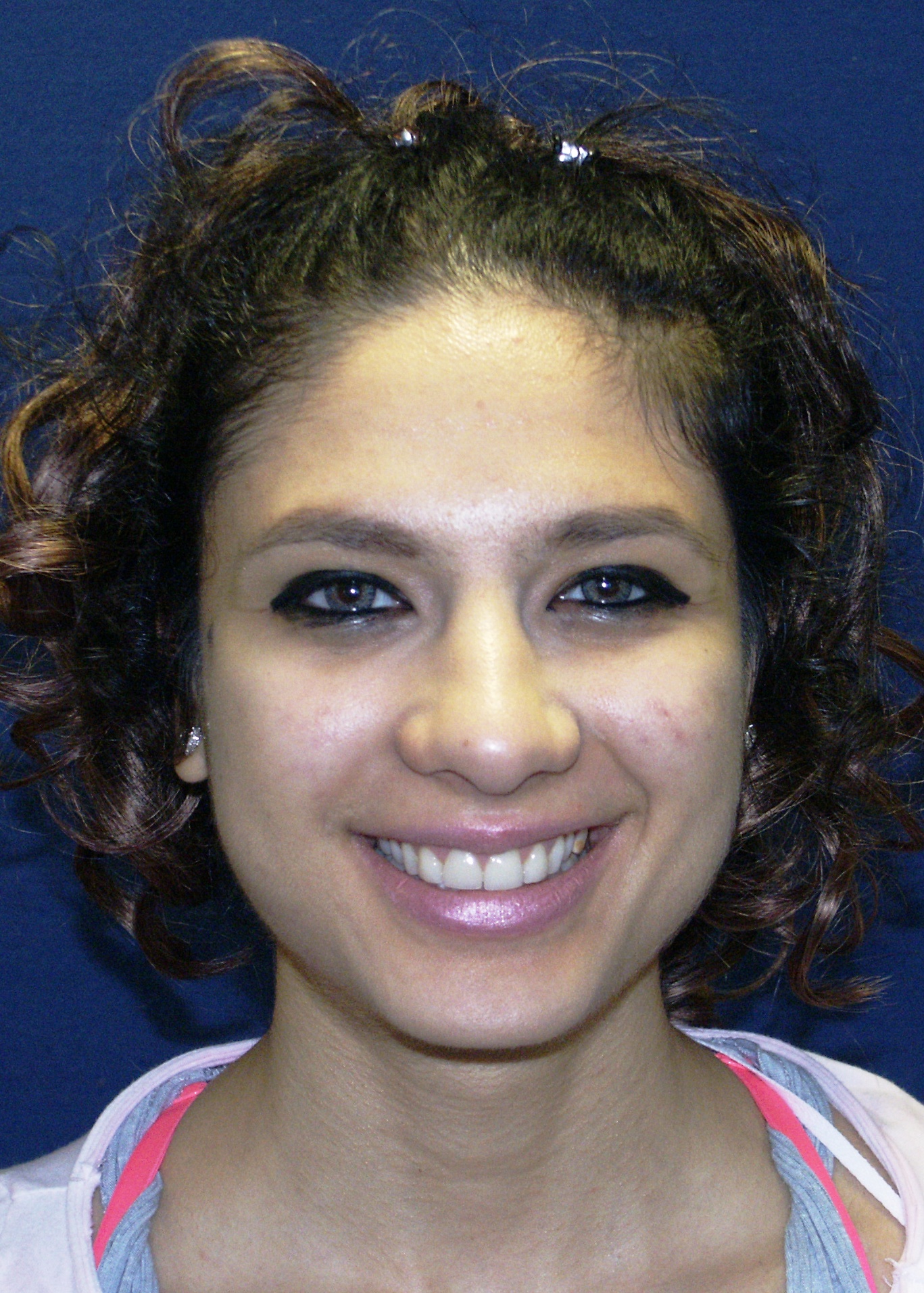 Dr A Poole - Drayton Medical Practice